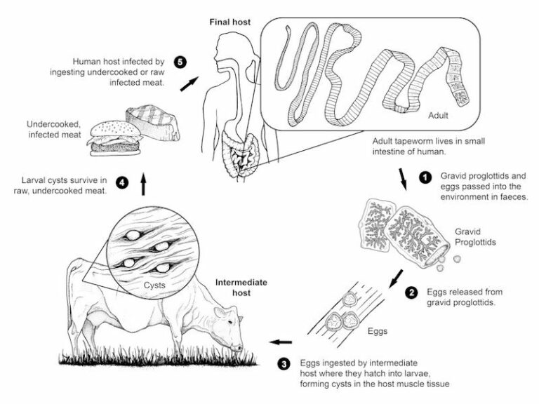Larval Tapeworm Life Cycle: Hydatids, Beef Measles and Bladder Worm ...