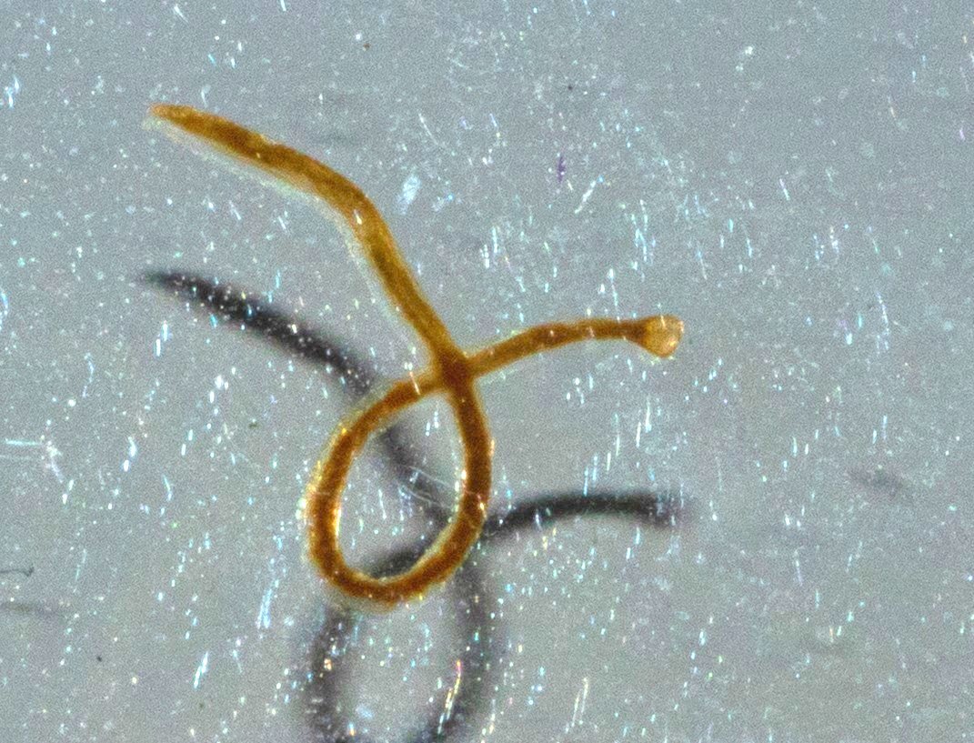 Large-Mouthed Bowel Worm in Cattle - WormBoss