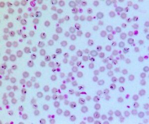 Theileriosis - WormBoss