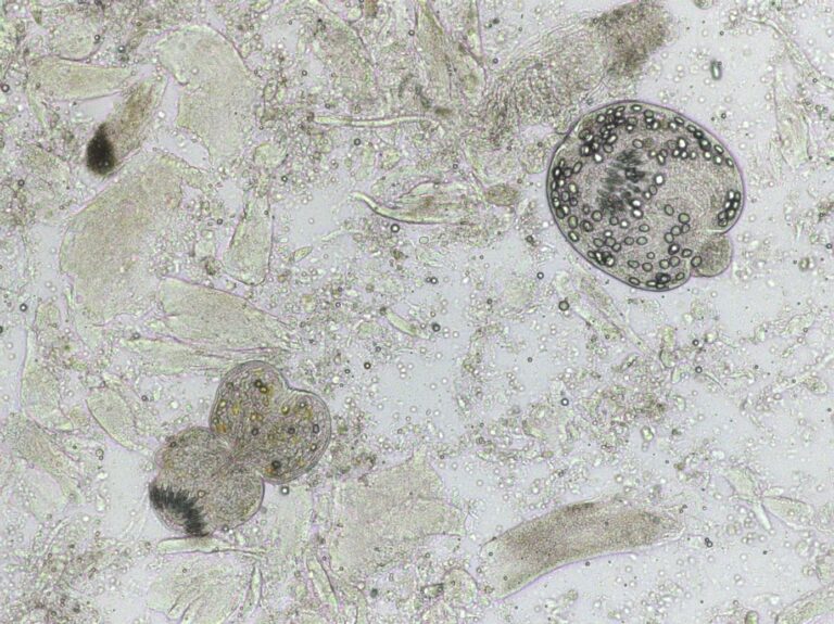 Hydatid Cysts - WormBoss