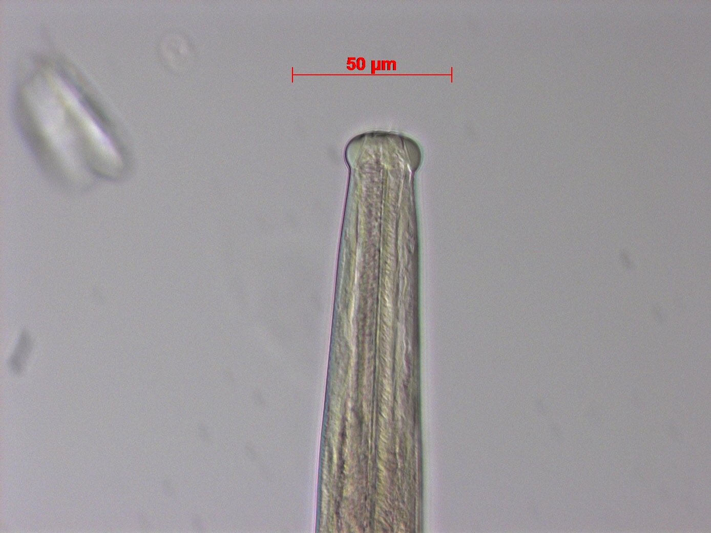 Small brown stomach worm - WormBoss