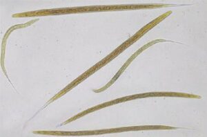 Worm Egg Counting for Sheep and Goats - WormBoss